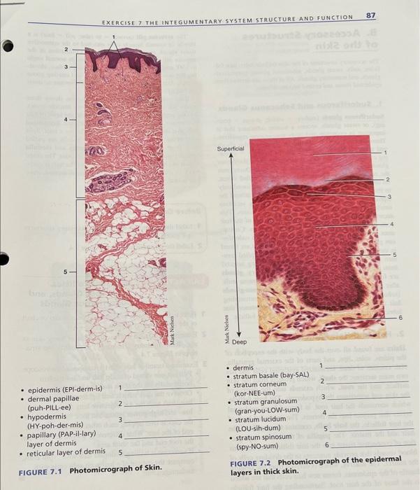 Solved - epidermis (EPI-derm-is) 1 - dermal papillae | Chegg.com