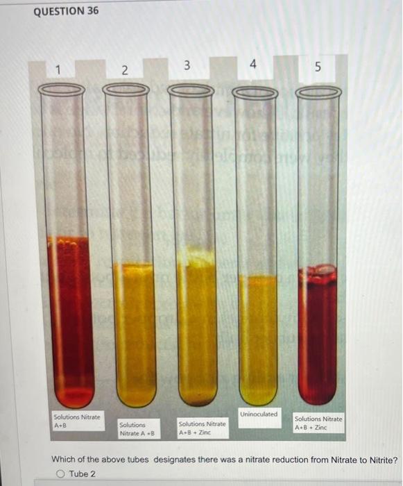 Solved Which of the above tubes designates there was a | Chegg.com