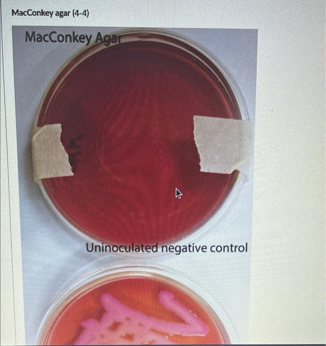 Solved MacConkey agar (4-4) MacConkey Agar Uninoculated | Chegg.com