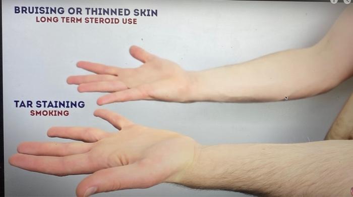 Solved This video is performing a "Respiratory | Chegg.com