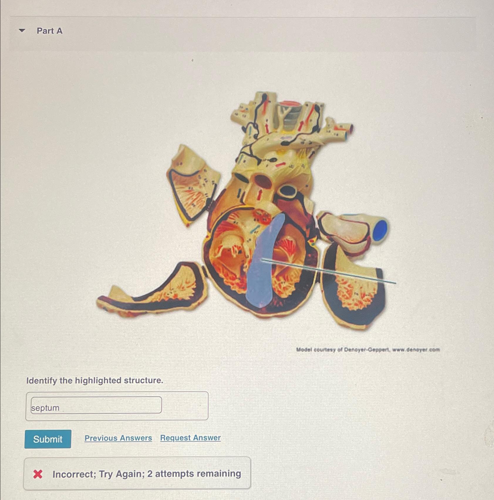 Solved Identify the highlighted part | Chegg.com