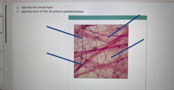 [Solved]: 1. Identify the tissue type 2. Identify each of t