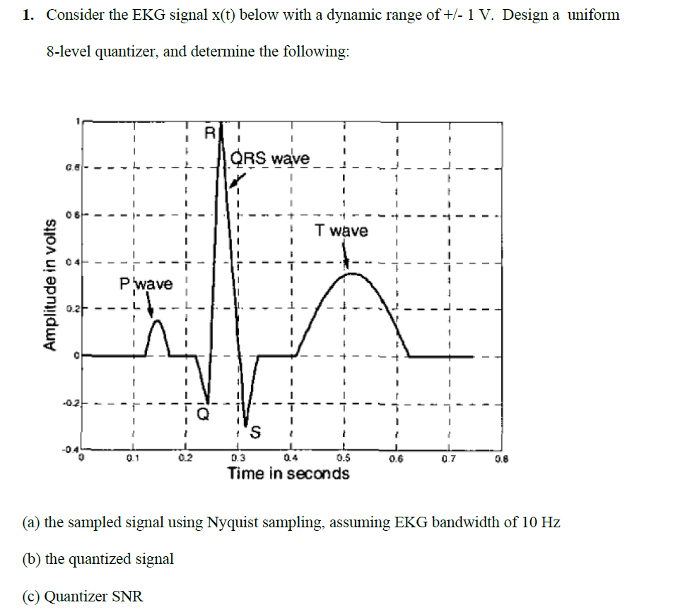 Solved 1. ﻿Consider the EKG signal \( ﻿x(t) \) ﻿below with a | Chegg.com