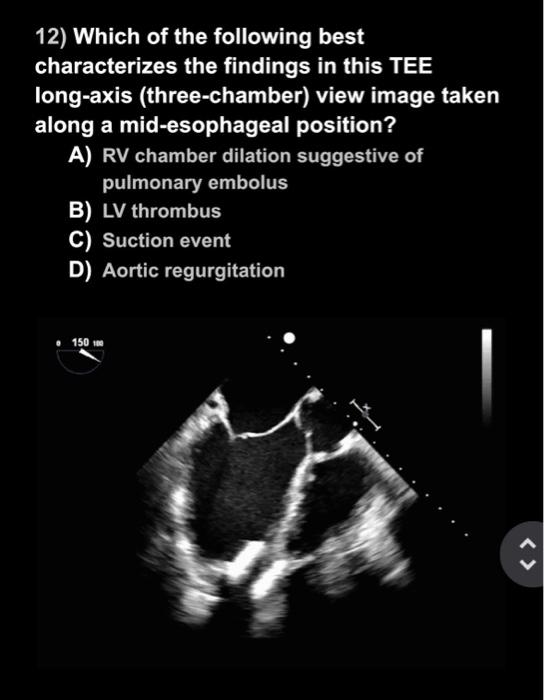 Solved 12) Which of the following best characterizes the | Chegg.com