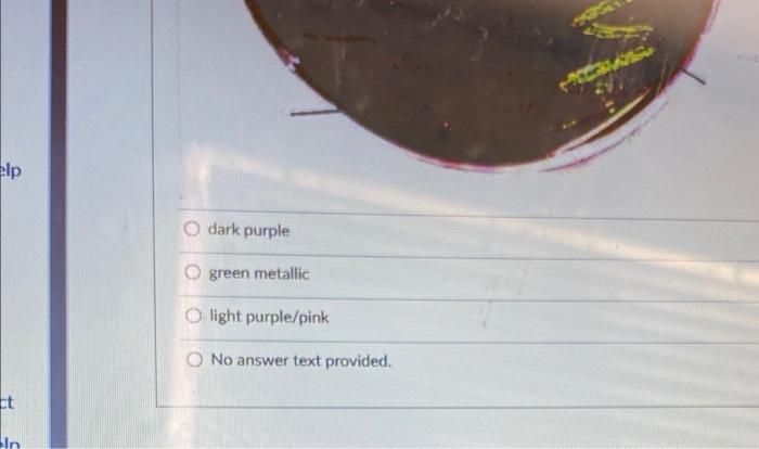 Solved This is an EMB plate. Which color streak is from E. | Chegg.com