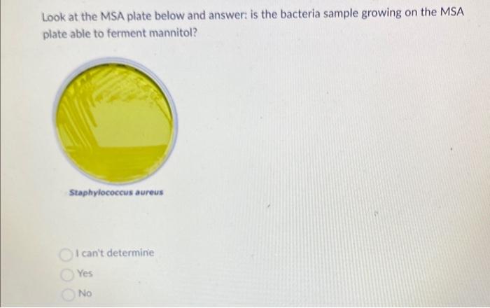 Solved Look at the MSA plate result below and answer: is the | Chegg.com