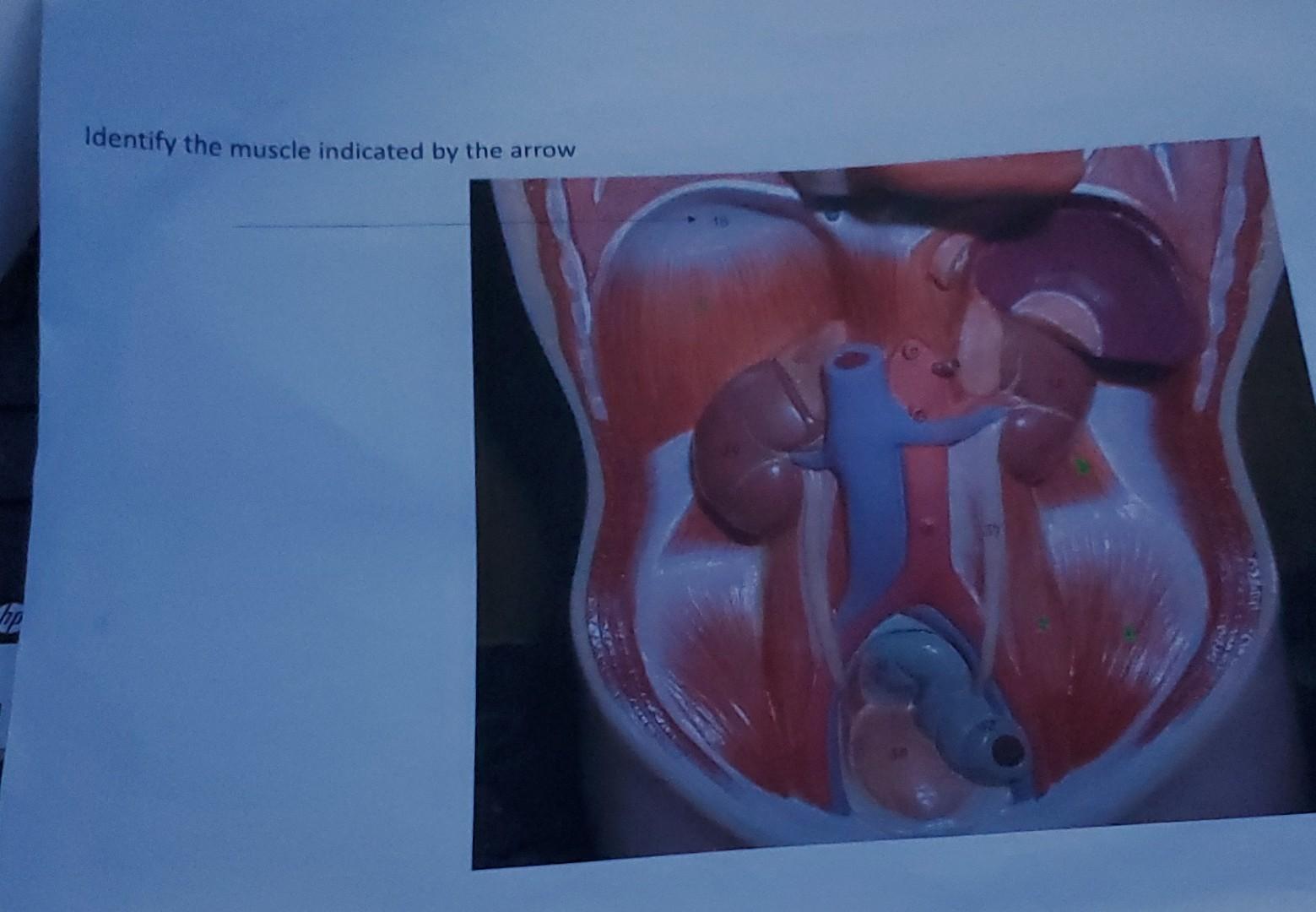 Solved Identify the muscle indicated by | Chegg.com