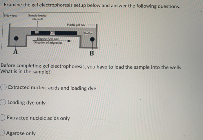 Solved Examine the gel electrophoresis setup below and | Chegg.com