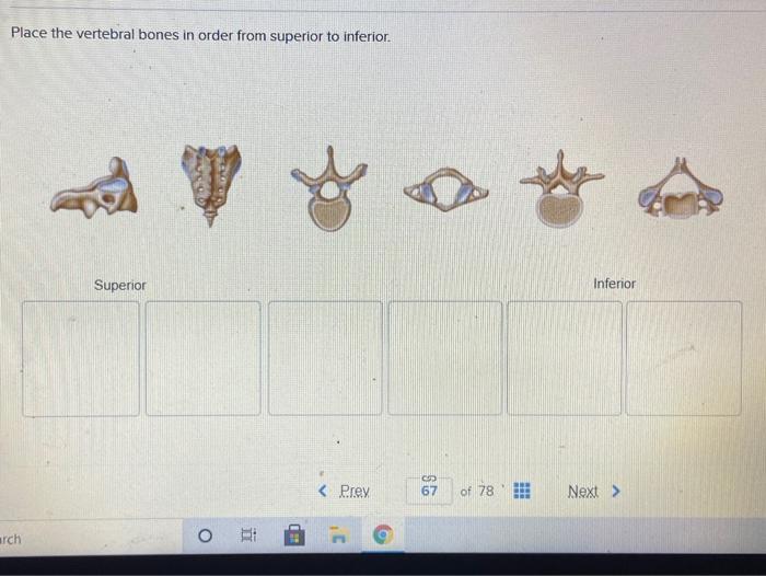 Solved Place the vertebral bones in order from superior to | Chegg.com