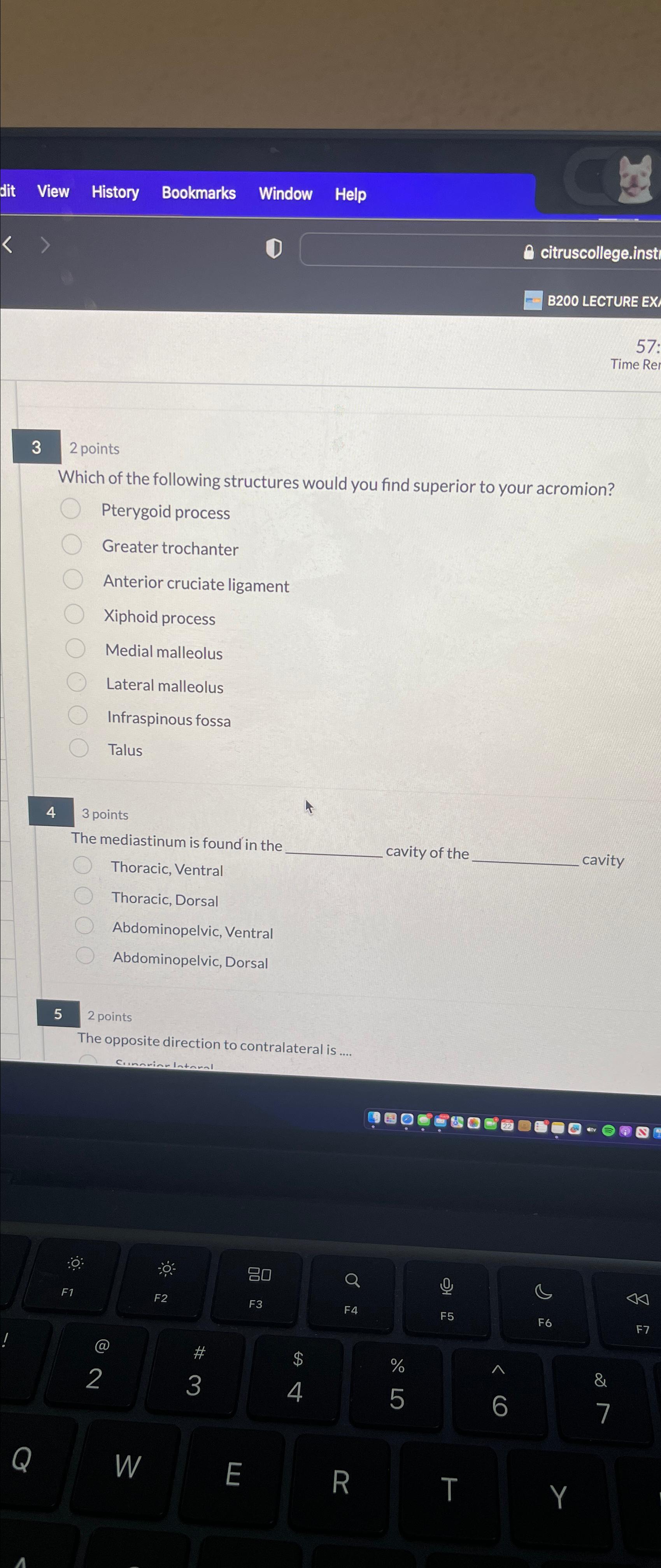 Solved 2 ﻿pointsWhich of the following structures would you | Chegg.com