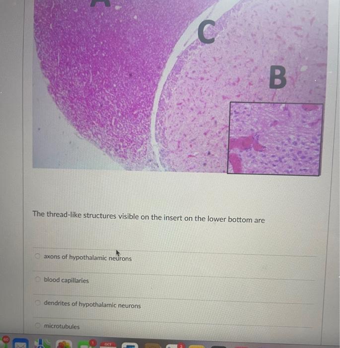 60 X The thread-like structures visible on the insert | Chegg.com
