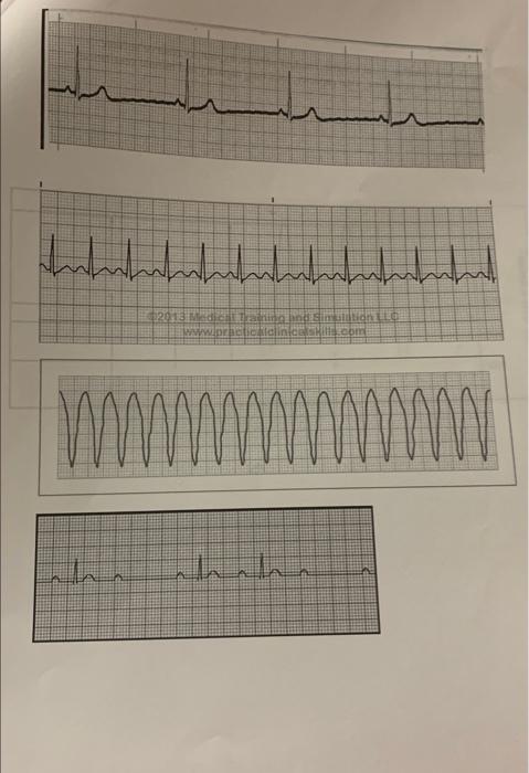 Solved ACID/BASE EXERCISES, EKG AND SPIROMETRY 1. pH-7.35 | Chegg.com