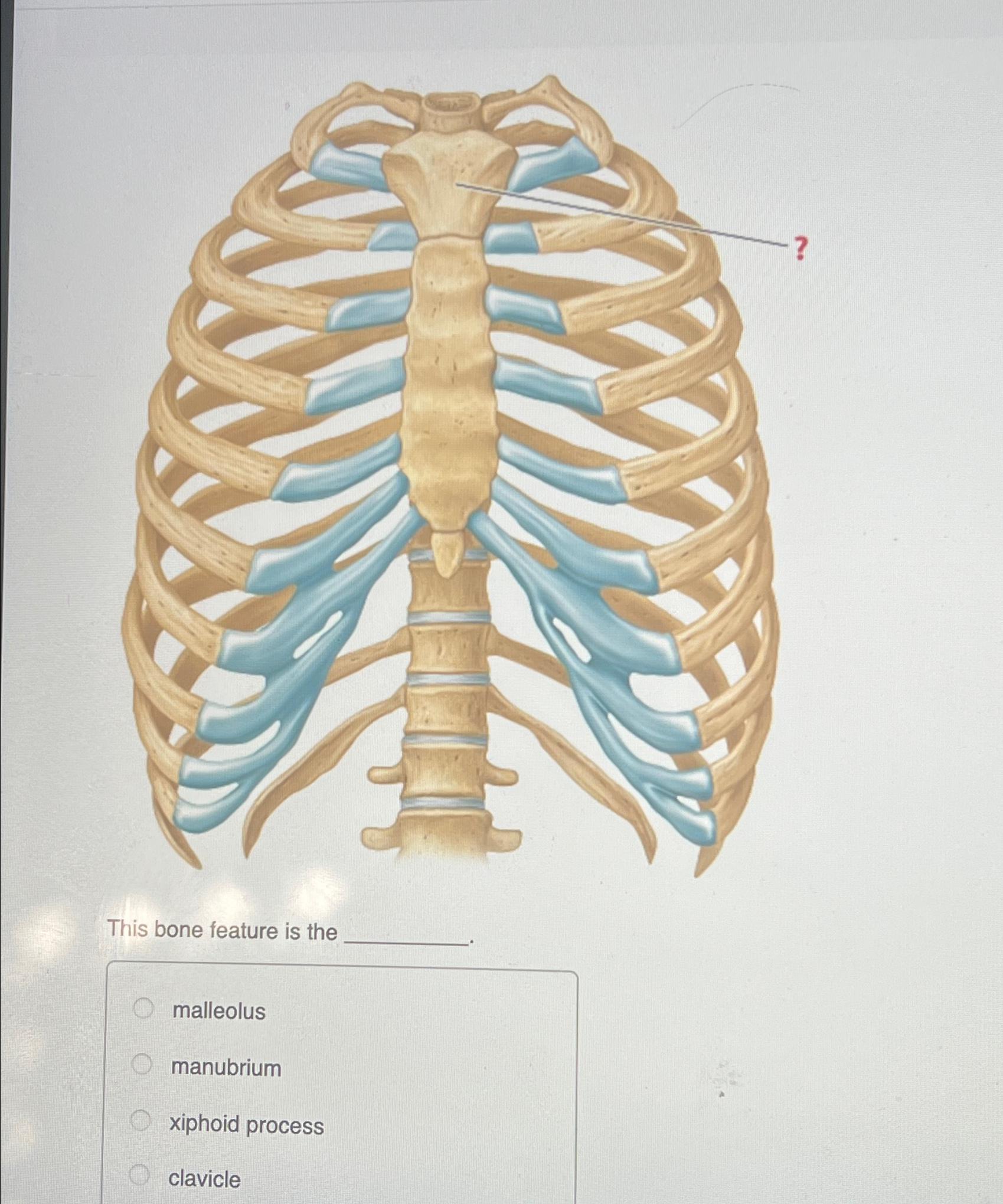 Solved This bone feature is themalleolusmanubriumxiphoid | Chegg.com