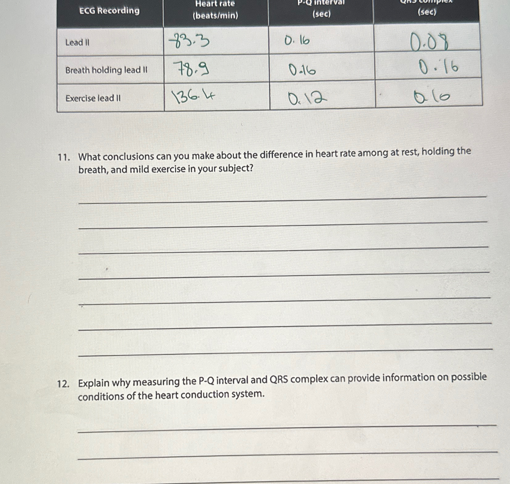 Solved \table[[ECG Recording,\table[[Heart | Chegg.com