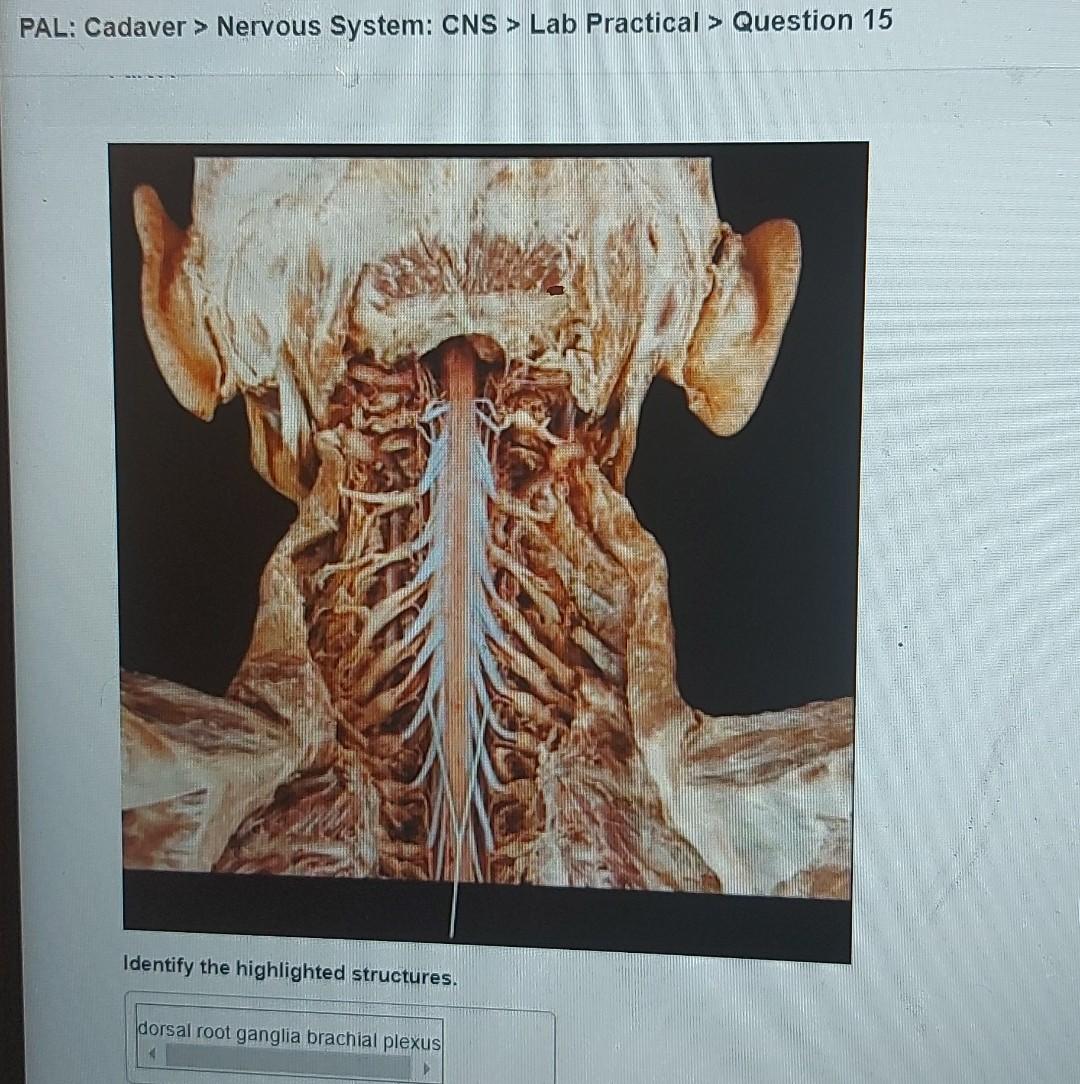 Solved Pal Cadaver Nervous System Cns Lab Practical