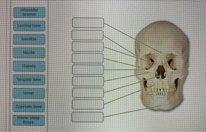 Solved w Ramus Mandibular angle Mental protuberance | Chegg.com