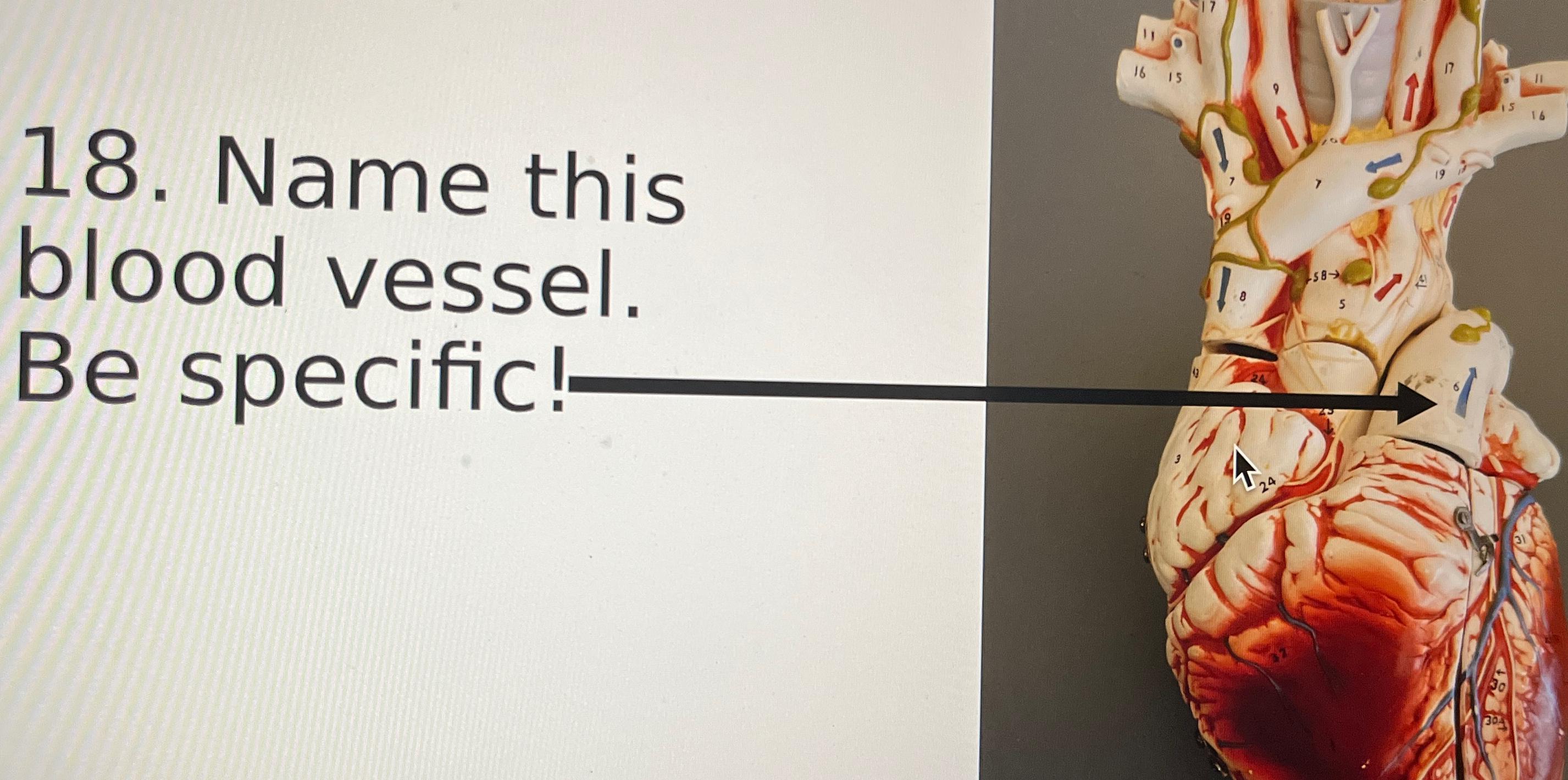 Solved Name this blood vessel. Be specific! | Chegg.com