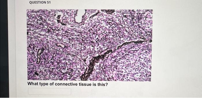 What type of connective tissue is this? QUESTION 33 | Chegg.com