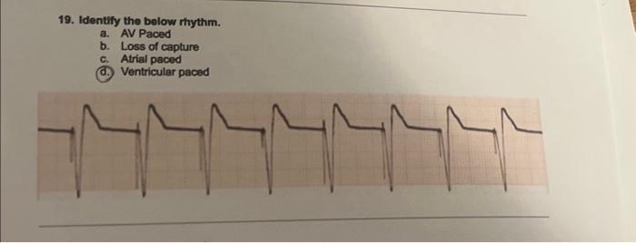 [Solved]: 19. Identify the below rhythm. a. AV Paced b. Los