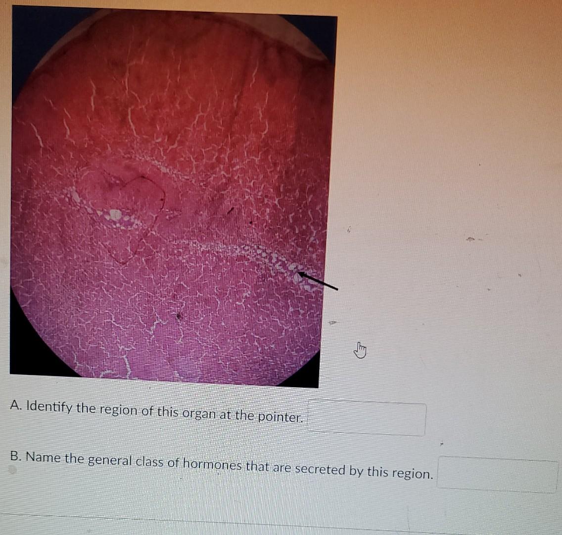 Solved A. Identify the region of this organ at the pointer. | Chegg.com