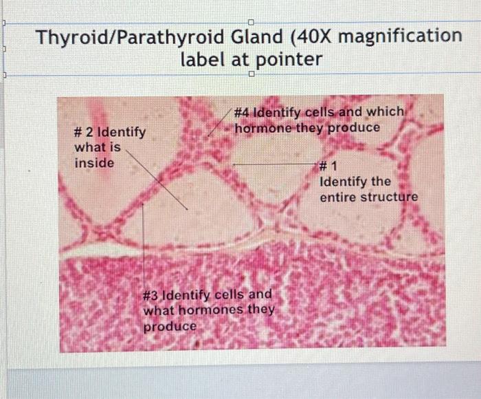 Solved Thyroid/Parathyroid Gland (40X magnification label at | Chegg.com