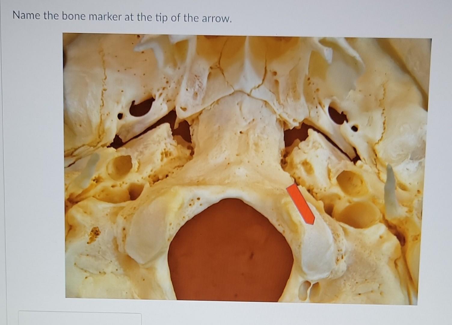 Solved Name the bone marker at the tip of the arrow. Name | Chegg.com