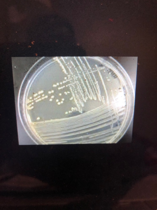 Solved Micrococcus luteus Escherichia coli 400 10-2 120 | Chegg.com