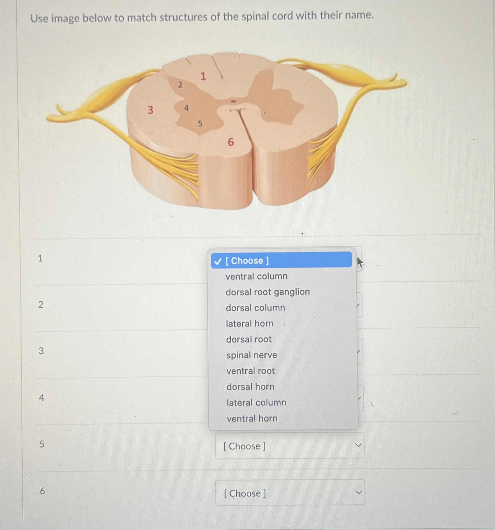 Solved Use image below to match structures of the spinal | Chegg.com