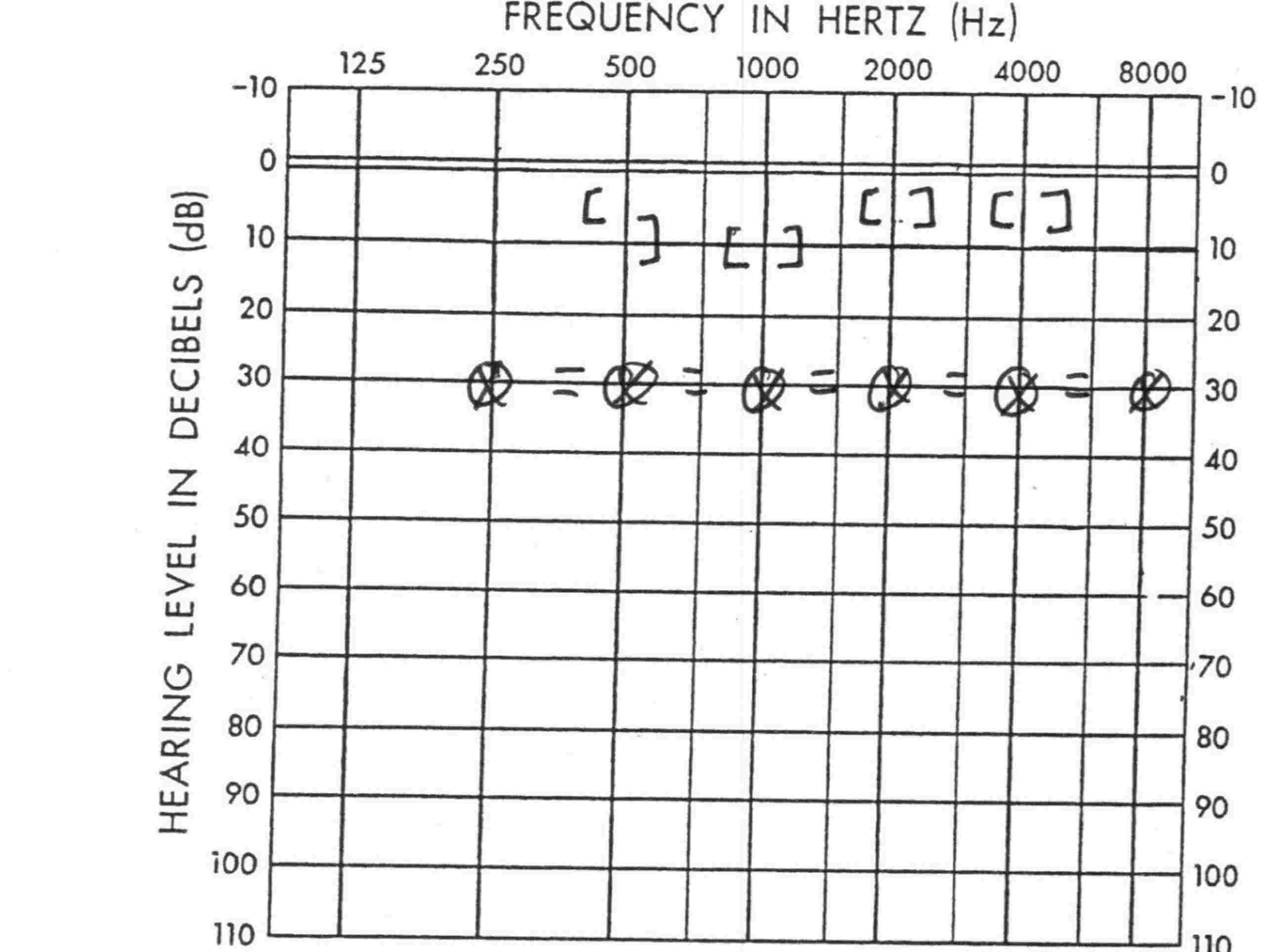Solved Interpret the audiogram above and calculate the pure | Chegg.com