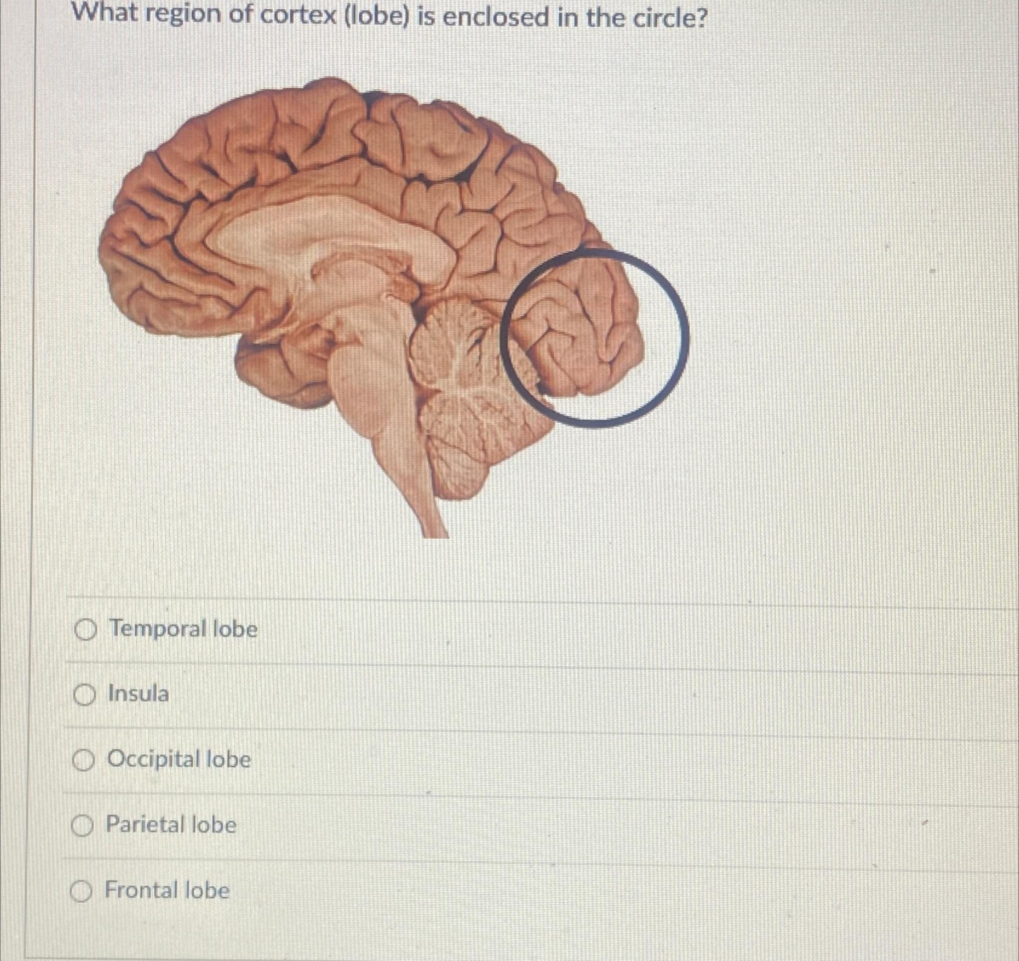 Solved What region of cortex (lobe) ﻿is enclosed in the | Chegg.com
