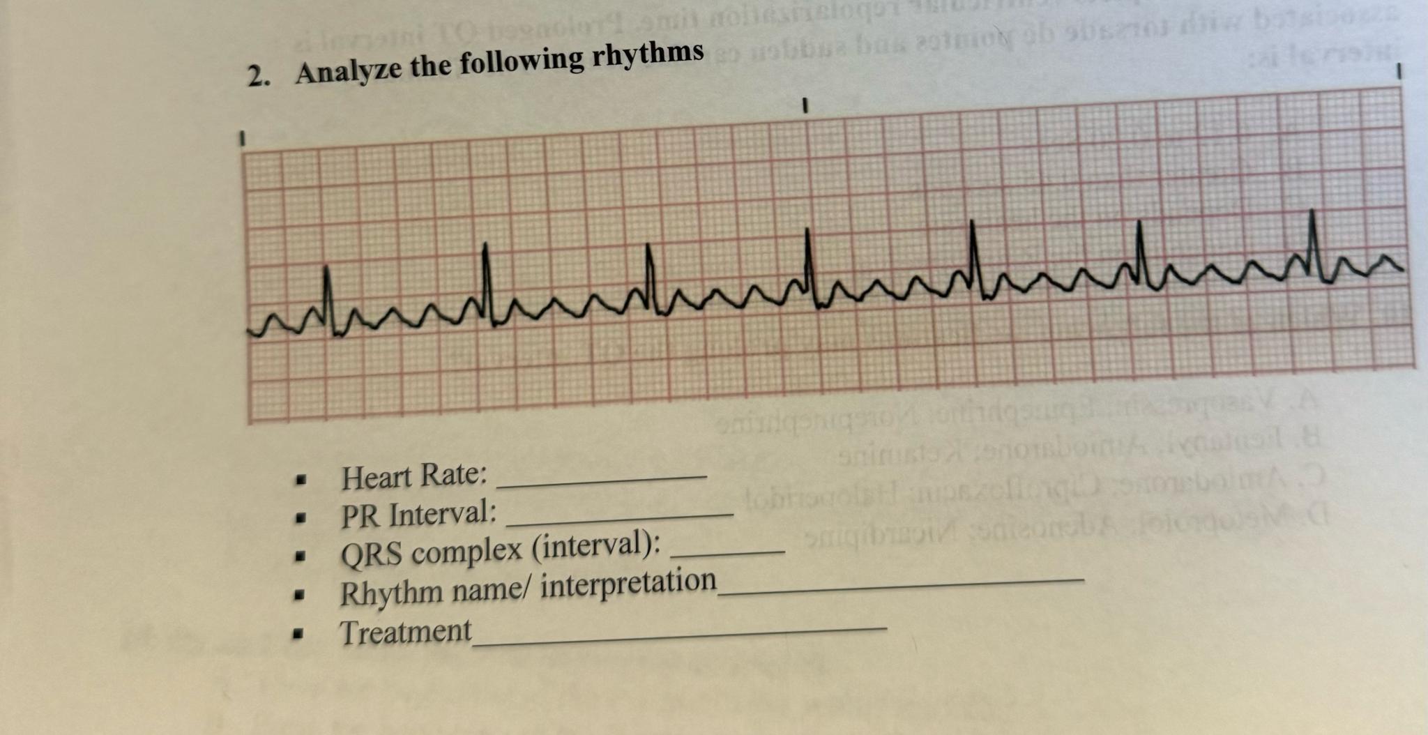 Solved Analyze the following rhythmsHeart Rate:PR | Chegg.com