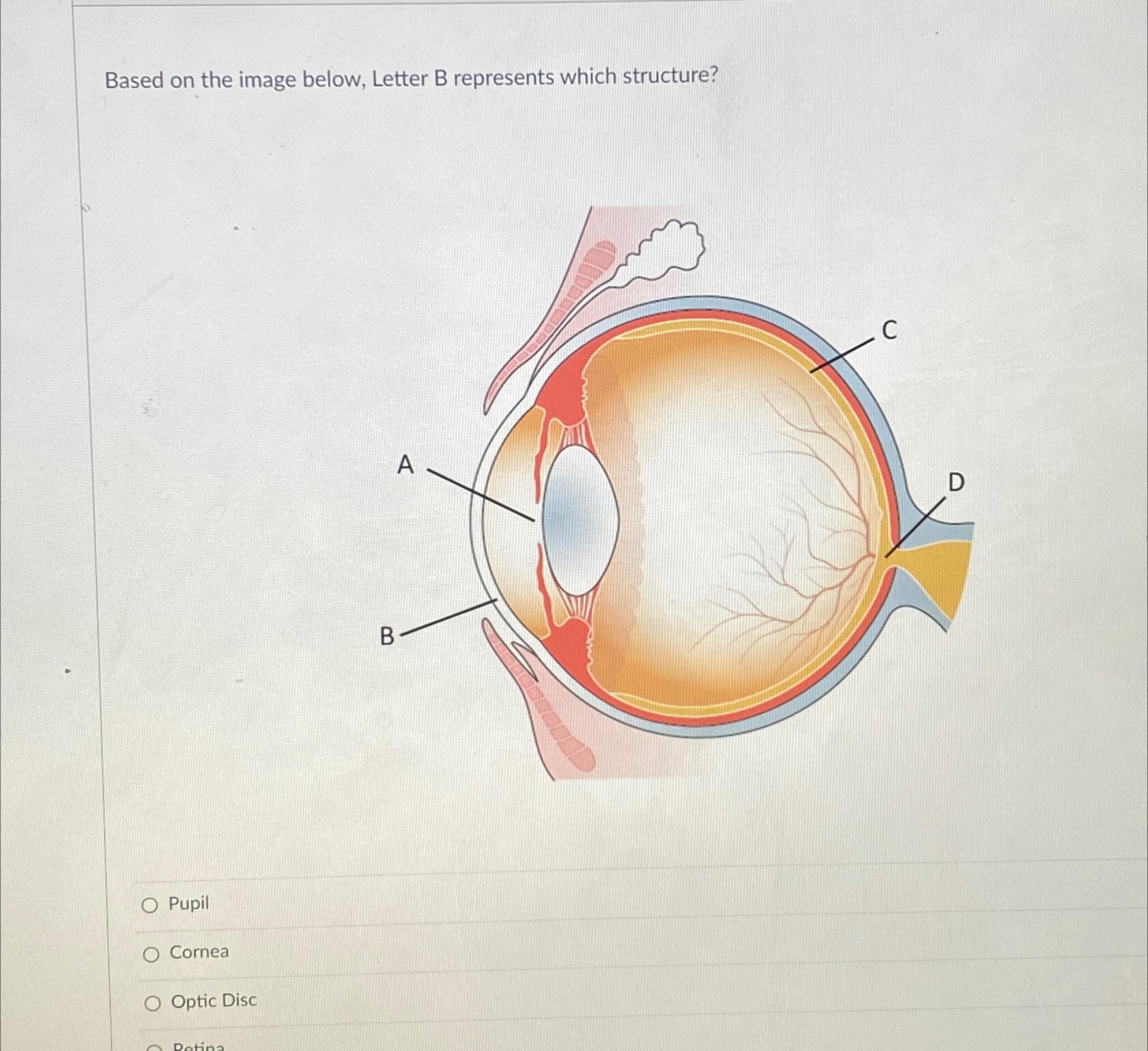 Solved Based on the image below, Letter B represents which | Chegg.com