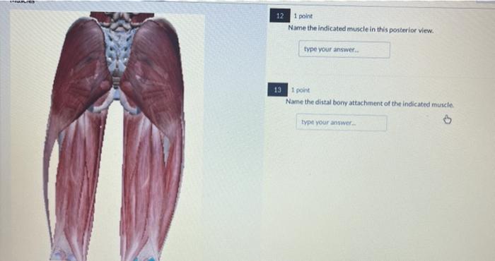Solved Name the indicated muscle in this posterior view. 1 | Chegg.com