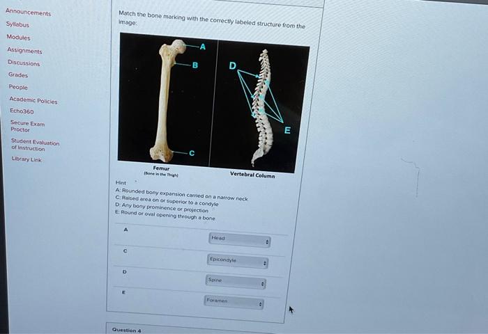 Solved Match the bone marking wth the correctly labeled | Chegg.com