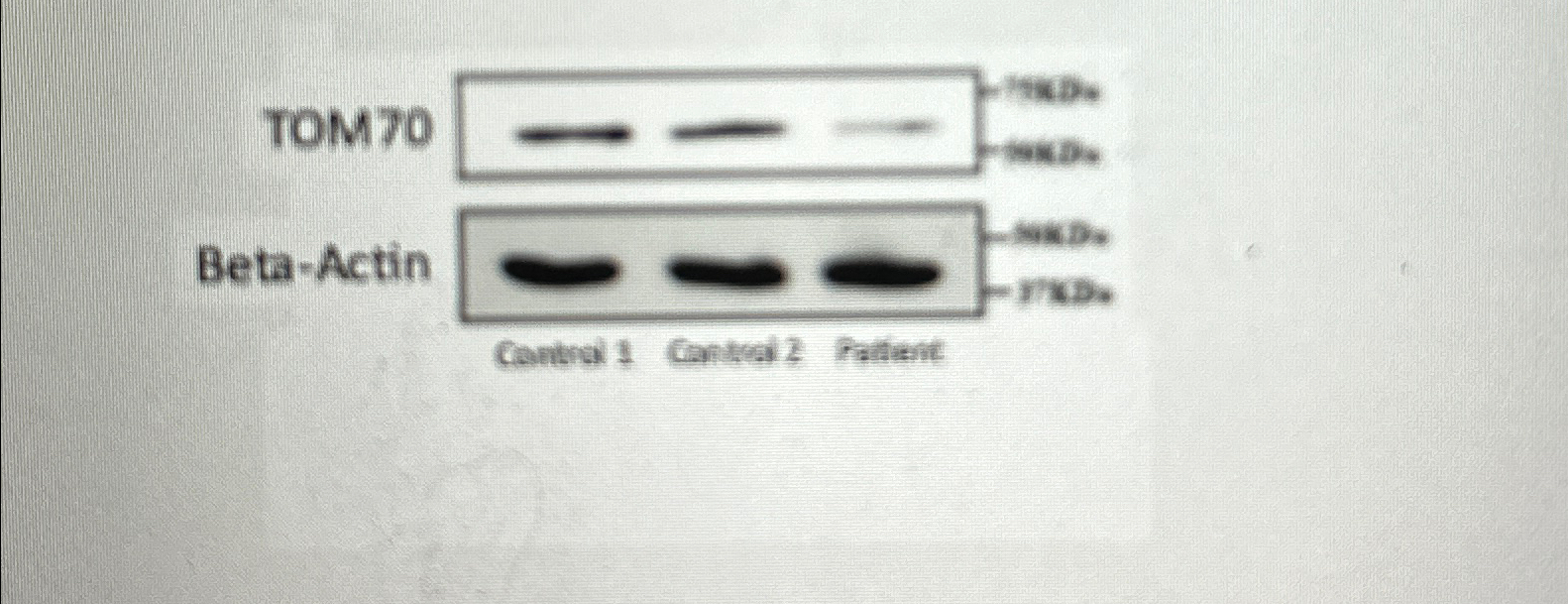 Solved Describe the results displayed in the Western blot | Chegg.com