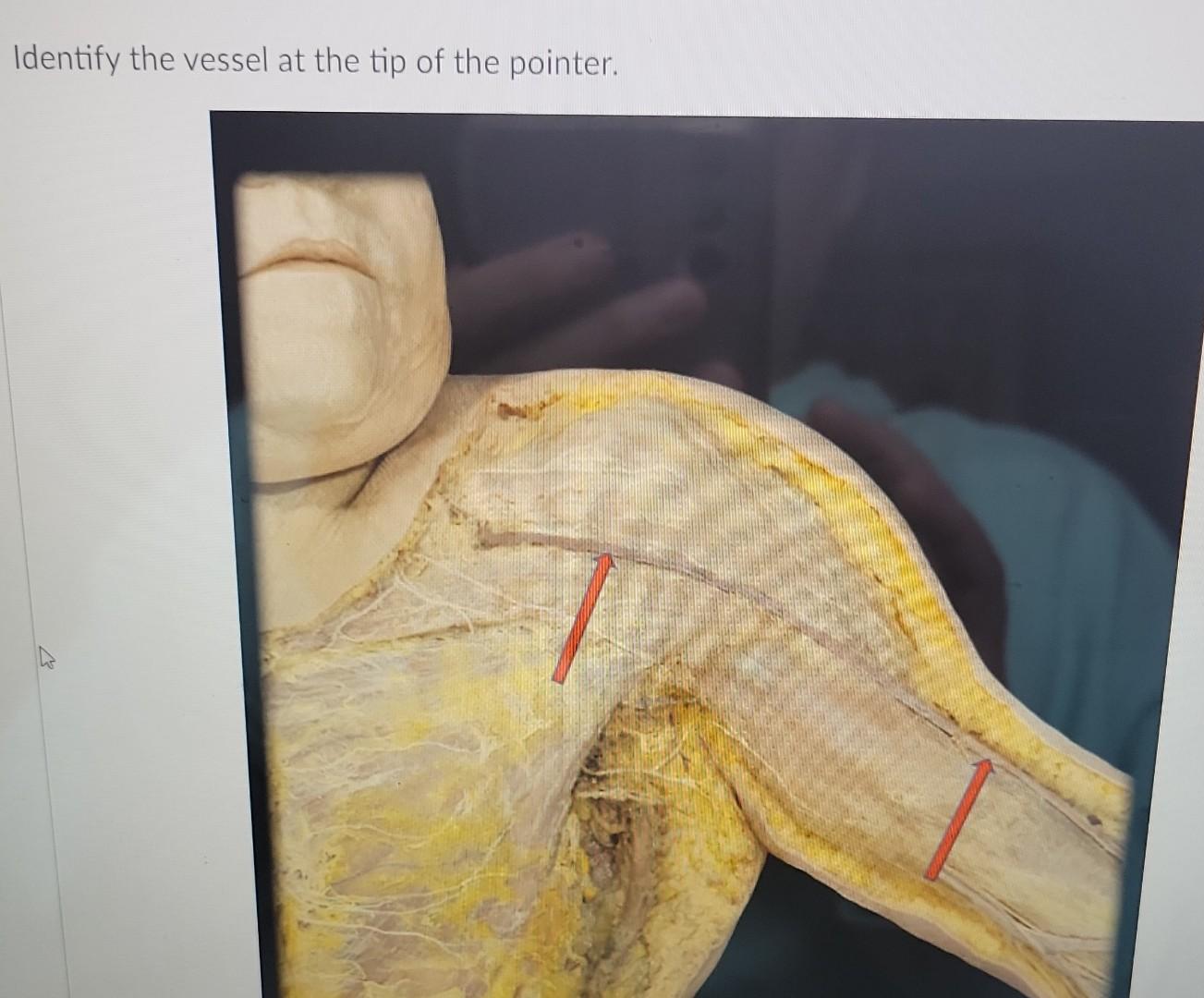 Solved y the vessel at the tip of the pointer.Identify the | Chegg.com