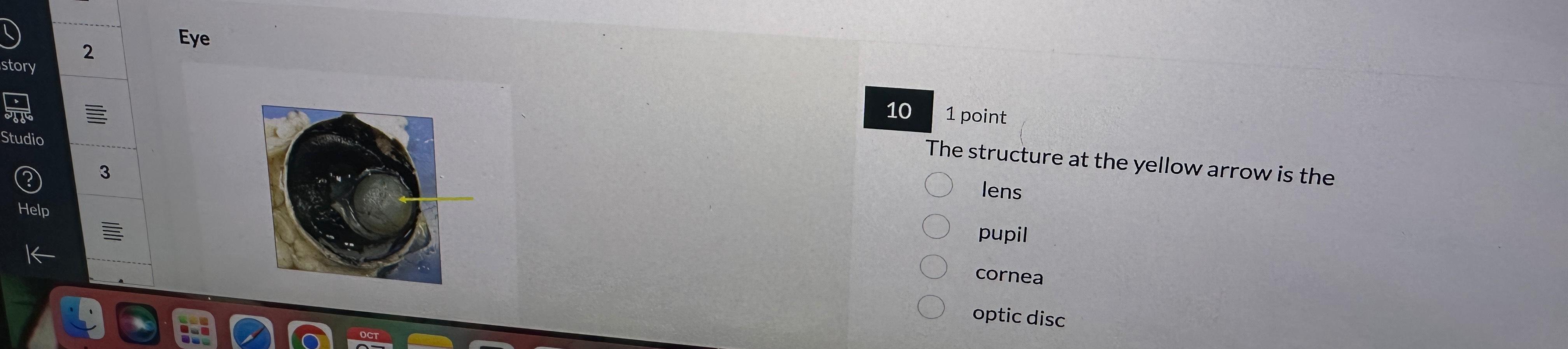 Solved The structure at the yellow arrow is | Chegg.com