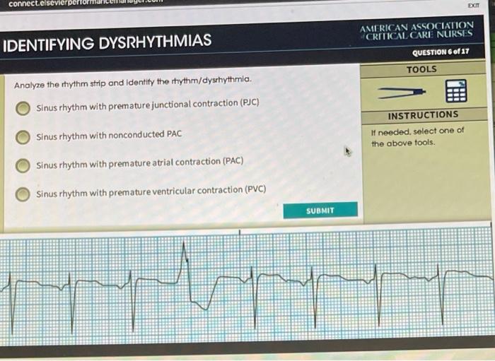 Solved connect.elsevier EXIT AMERICAN ASSOCIATION CRITICAL | Chegg.com