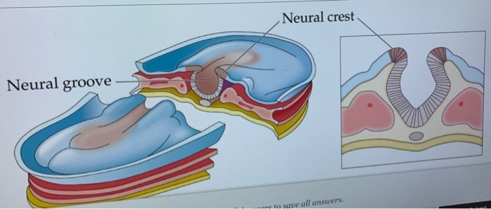 Solved Neural crest Neural groove - to save all answers. | Chegg.com