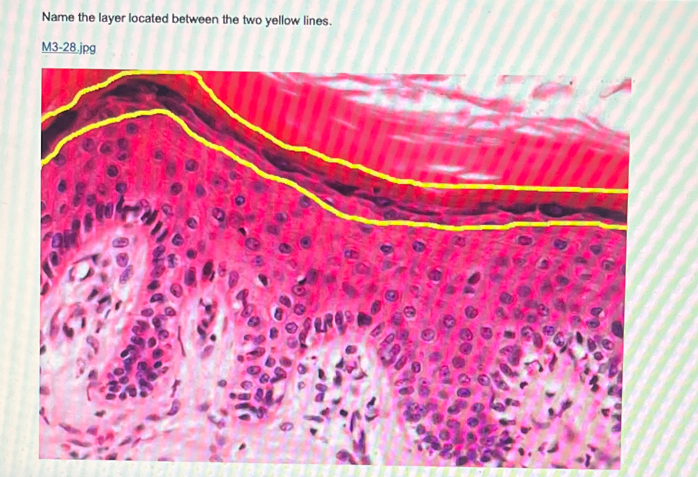 Solved Name the layer located between the two yellow | Chegg.com