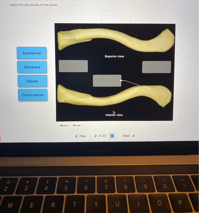 Solved Label the structures of the bone Acromial and | Chegg.com