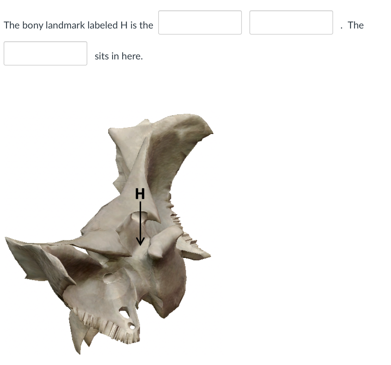 Solved The bony landmark labeled H ﻿is thesits in here. | Chegg.com