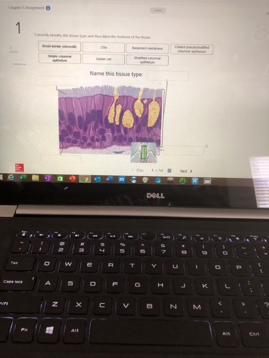 Solved Chapter 5 Assignment 1 Correctly identify this issue | Chegg.com