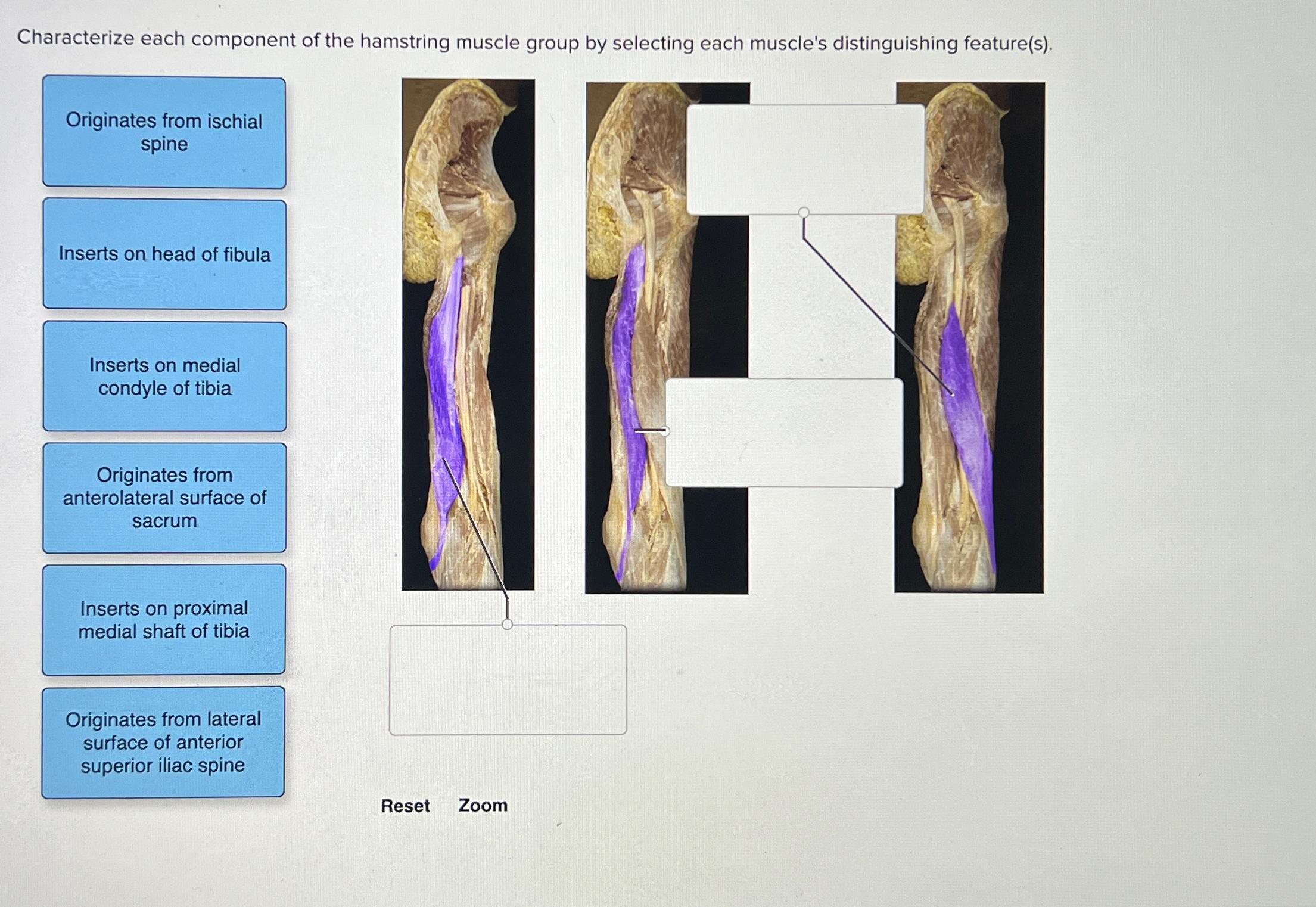 Solved Characterize each component of the hamstring muscle | Chegg.com