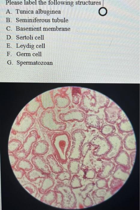 Solved Please label the following structures A. Tunica | Chegg.com