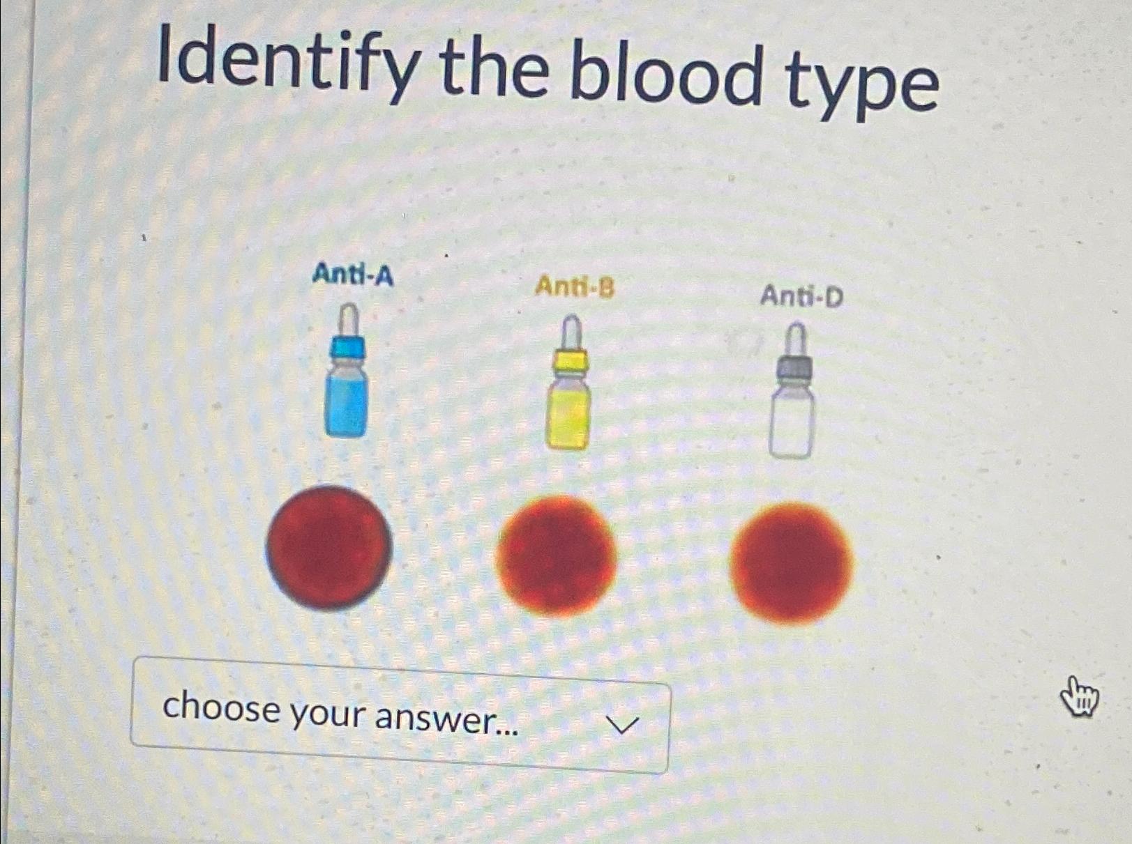 Solved Identify the blood typeAnti-AAnti-BAnti-D | Chegg.com
