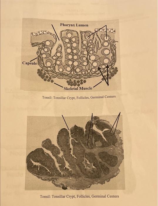 Solved Pharynx Lumen Capsule 2858 Skeletal Muscle Tonsil: | Chegg.com
