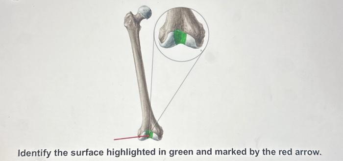 Solved Identify the surface highlighted in green and | Chegg.com