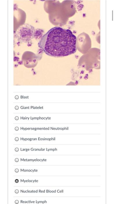 Solved Blast Giant Platelet Hairy Lymphocyte Hypersegmented | Chegg.com