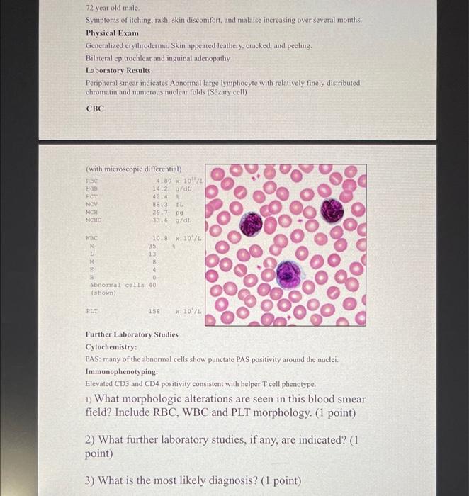 Solved 72 year old male. Symptoms of itching, rash, skin | Chegg.com